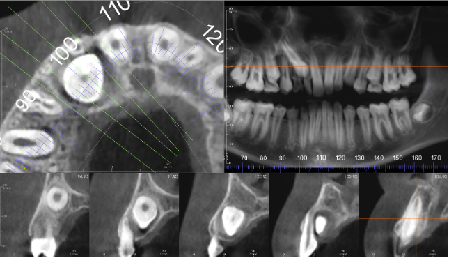 Orthodontic Offices CBCT Imaging – Pearl CBCT – Dr. Morvarid Poorsattar