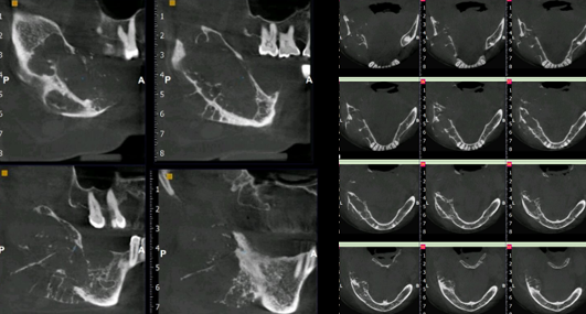Services – Pearl CBCT – Dr. Morvarid Poorsattar