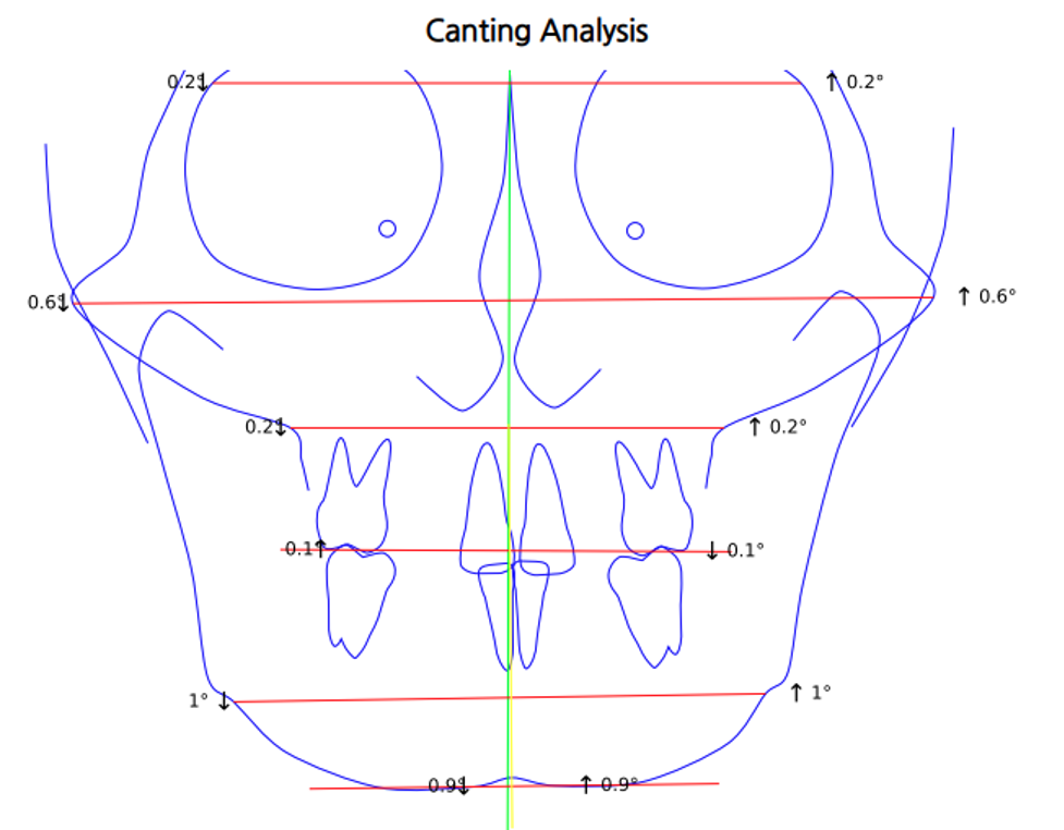 Orthodontic Offices CBCT Imaging – Pearl CBCT – Dr. Morvarid Poorsattar