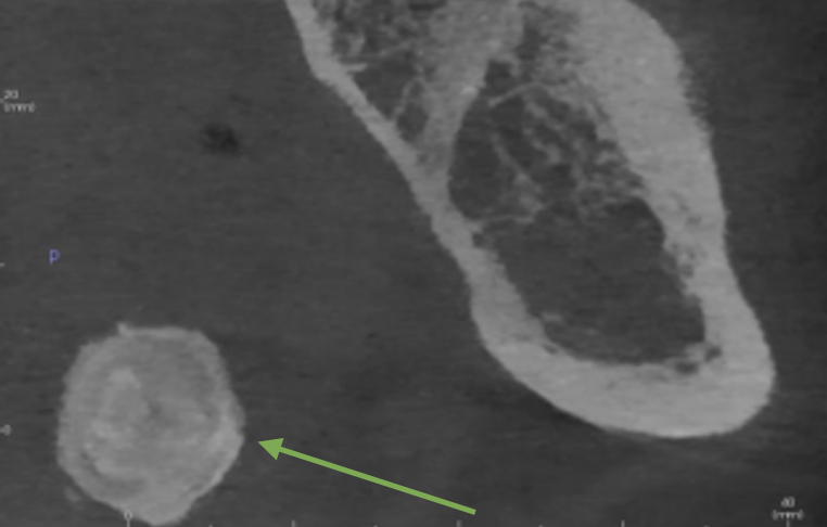 Services – Pearl CBCT – Dr. Morvarid Poorsattar