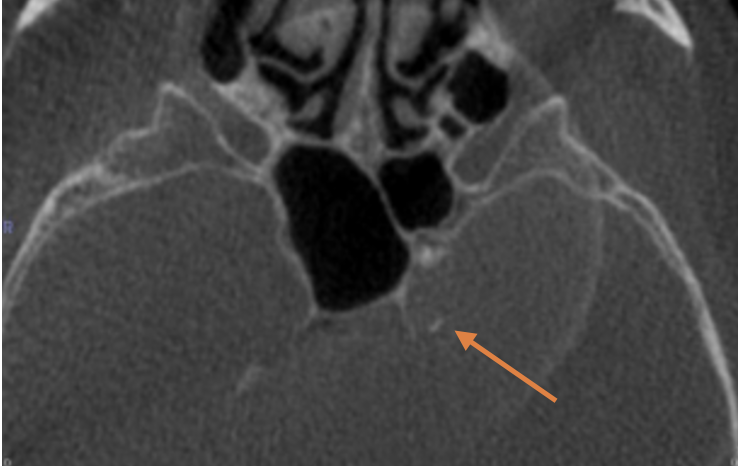 Services – Pearl CBCT – Dr. Morvarid Poorsattar