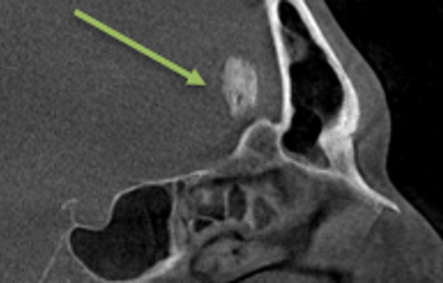 Services – Pearl CBCT – Dr. Morvarid Poorsattar