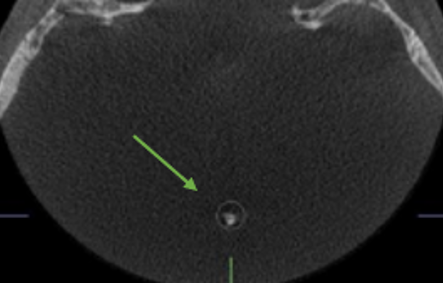 Services – Pearl CBCT – Dr. Morvarid Poorsattar