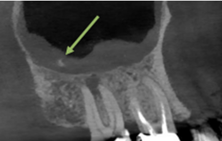 Services – Pearl CBCT – Dr. Morvarid Poorsattar