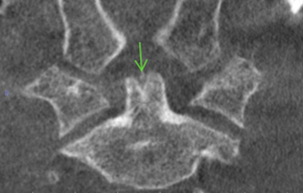 Services – Pearl CBCT – Dr. Morvarid Poorsattar