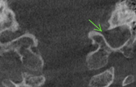 Services – Pearl CBCT – Dr. Morvarid Poorsattar