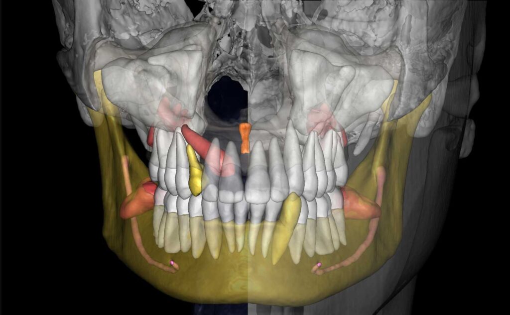 Orthodontic Offices CBCT Imaging – Pearl CBCT – Dr. Morvarid Poorsattar